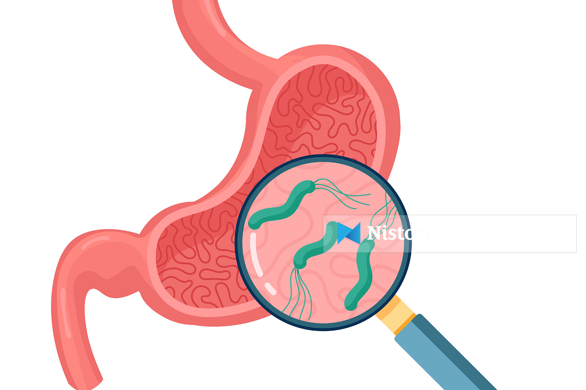 Çfarë ushqimi u rekomandohet të sëmurëve nga “Helicobacter pylori ...